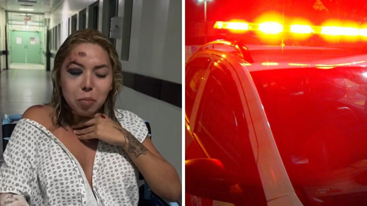 Problema no pagamento e fratura: o relato de passageira atropelada após ...